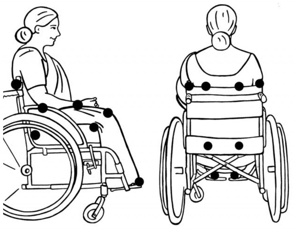 Ce sunt escarele, de ce apar și care sunt zonele predispuse? – Viață ...